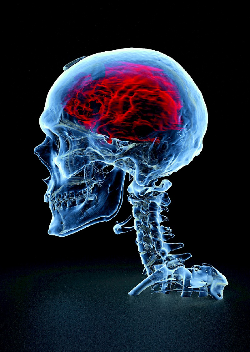 Post mortem – Knowledge Visualization ZHdK