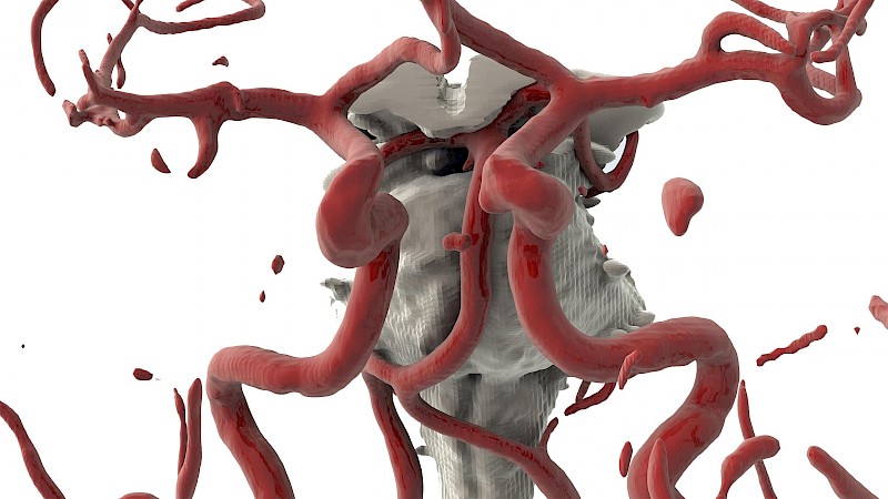 Interaktiver digitaler 3D-OP-Situs – Knowledge Visualization ZHdK