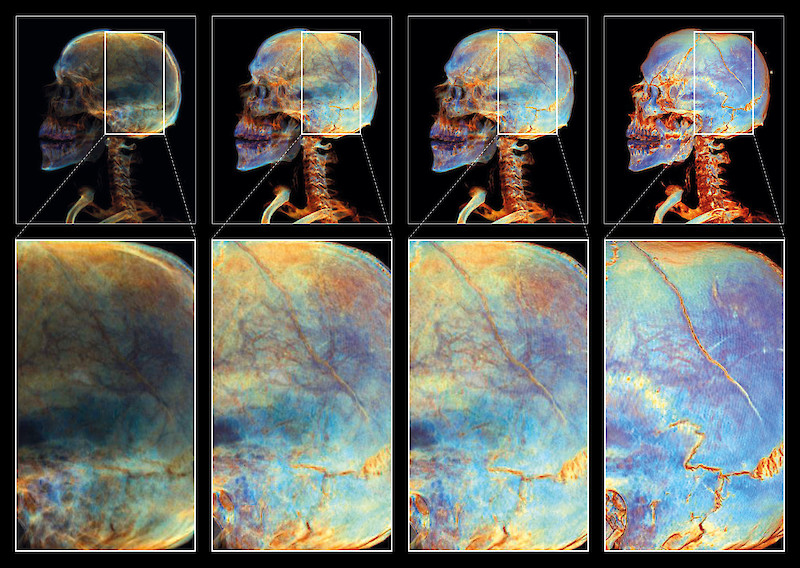 Farbe und Erkenntnis in der virtuellen Autopsie – Knowledge Visualization ZHdK